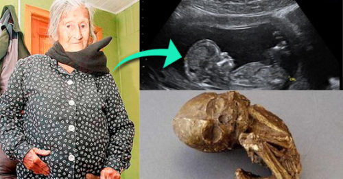 Photos: Meet 91year Old Woman Who Carried A Baby In Her Womb For More ...